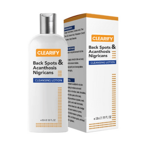 Clearify - Loção de Limpeza Anti Acne, Espinhas e Manchas